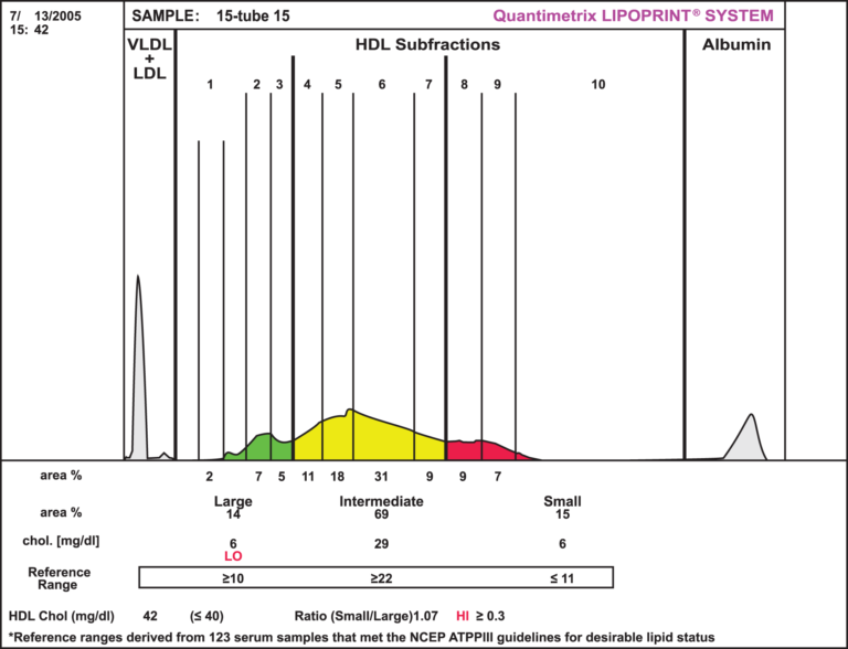 Lipoprint® HDL Subfractions Test