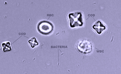 Dip&Spin® Urinalysis Dipstick & Microscopics Control